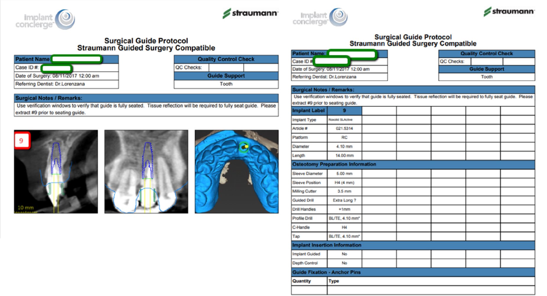 A Guided Solution to Immediate Extract Immediate Placement in the ...
